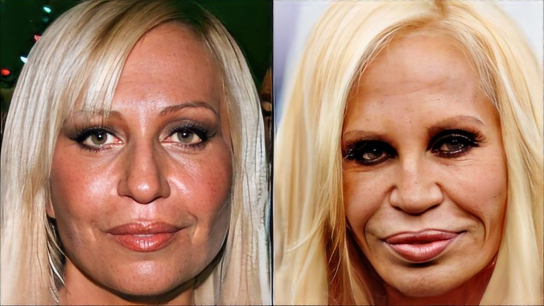 Top 10 Worst Celebrity Plastic Surgery Fails of All Time