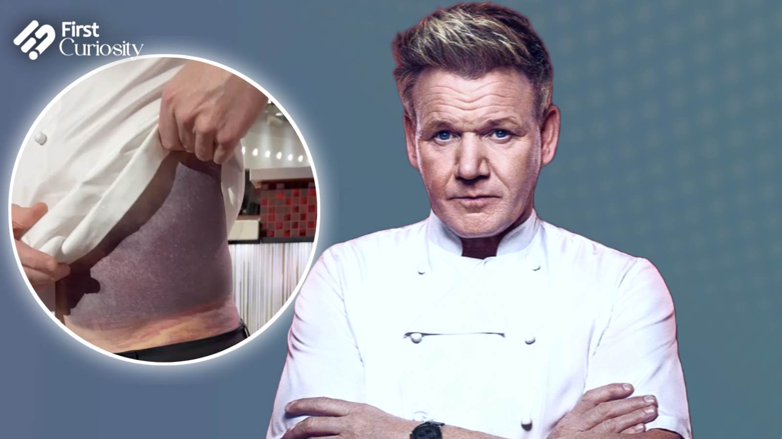 Watch: Gordon Ramsay Shows His Horrifying Injuries From A Recent ...