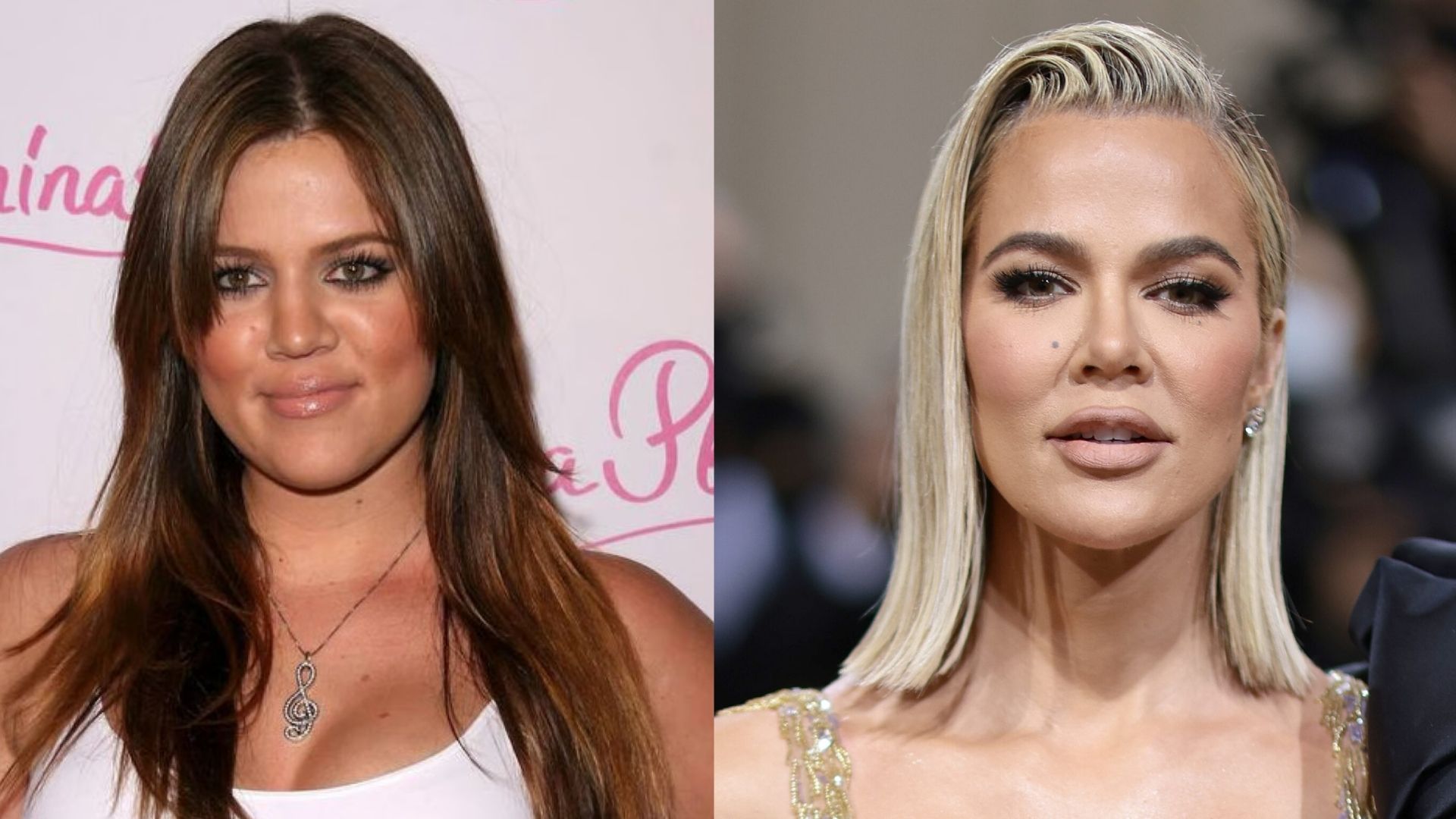 Celebrities Who Almost Ruined Their Beauty With Buccal Fat Removal - FirstCuriosity